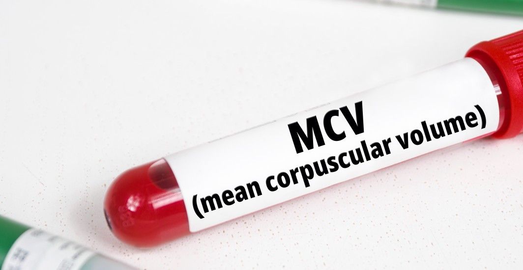 Mcv Blood Test Normal Range Purpose Procedure And Results